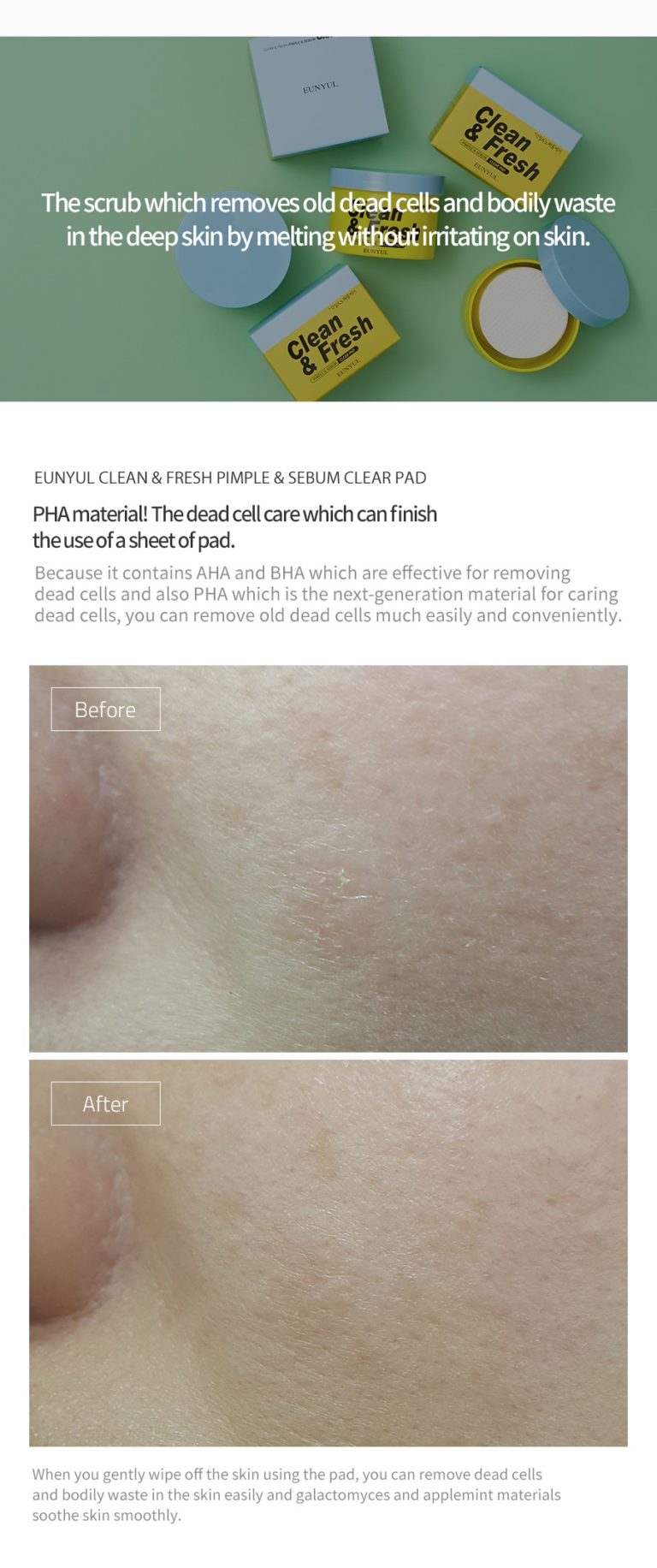 Buy Clean & Fresh Pimple & Sebum Clear Pad at Low Price - TofuSecret